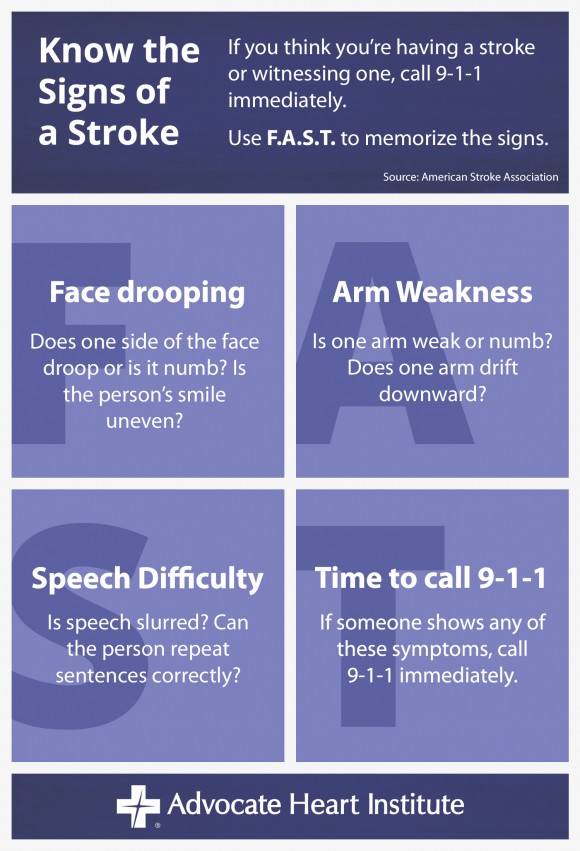 Infographic: Know the signs of a stroke | health enews