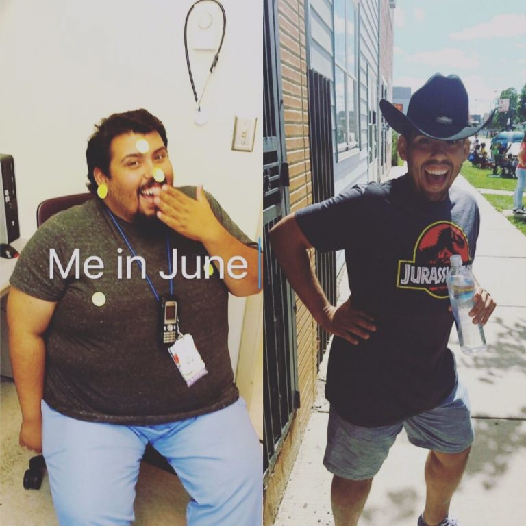 Nurse loses 157 pounds in one year | health enews